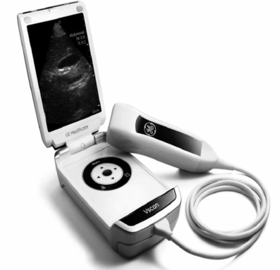 GE VScan Pocket Ultrasound | Engineering For Change
