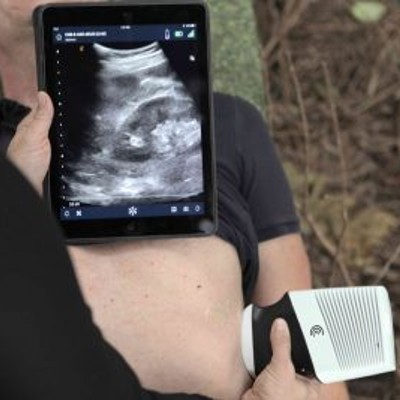 Clarius Ultrasound | Engineering For Change