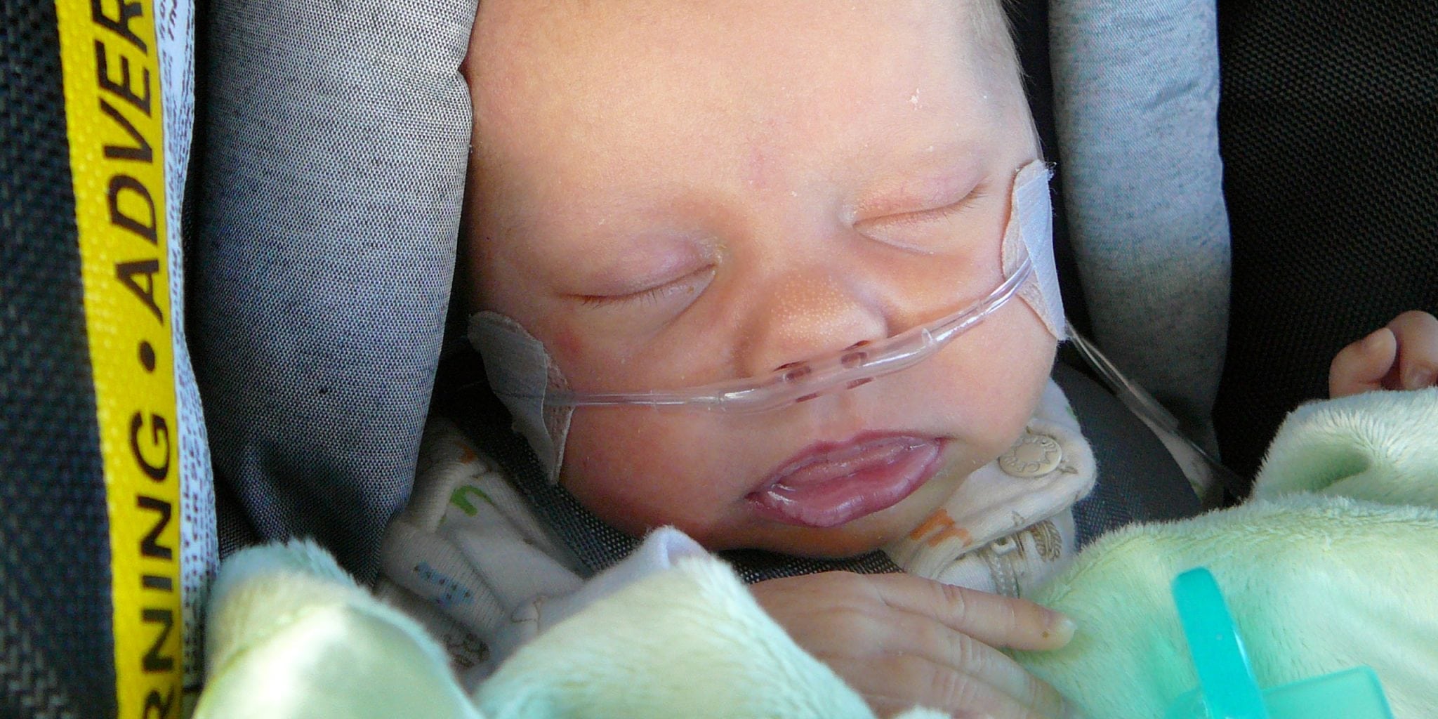 An Easier Way to Deliver Nitric Oxide for Pulmonary Hypertension