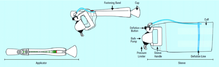 Odon Device | Engineering For Change