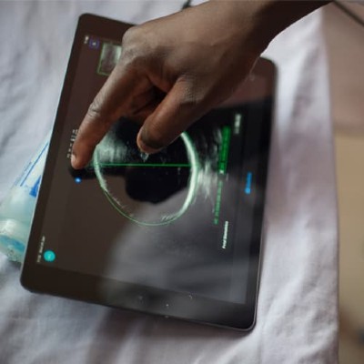 Butterfly iQ | Engineering For Change