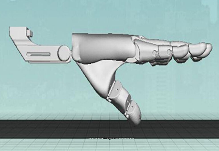 Software Has Dramatically Improved Prosthetic 3D Design | Engineering ...